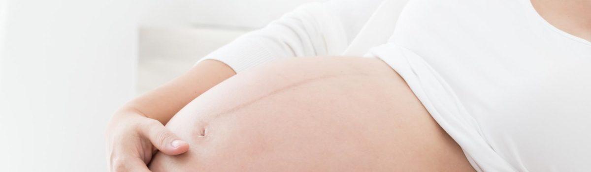 What That Line On Your Stomach Is - Linea Alba, Linea Nigra